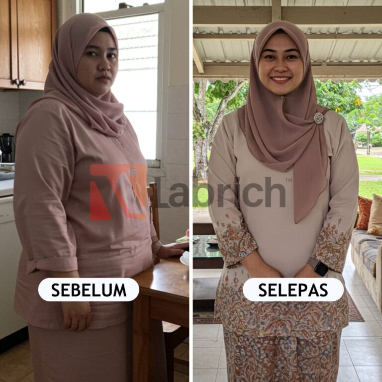 Labrich Probiotic – Misi Kurus Dan Cantik 2025